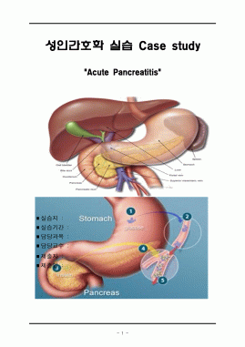 Acute pancreatitis Case study, 학생간호사 및 신규간호사 공부-1페이지