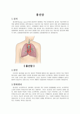 성인2 질환보고서 흉선암-1페이지