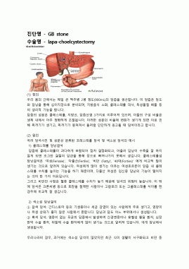 진단명-GB stone(담석), 수술명 - lapa-cholecystectomy(복강경식 담낭적출술)-1페이지