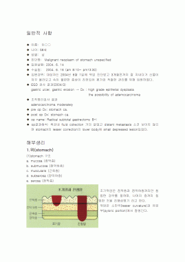 수술실보고서(위암수술)-1페이지