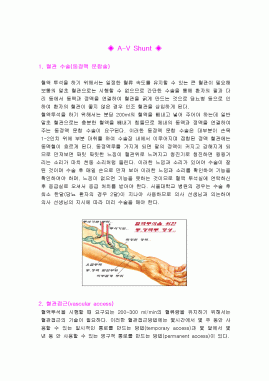 수술의 정의와 절차(30개정도 수술& 각각 그림포함 )-1페이지