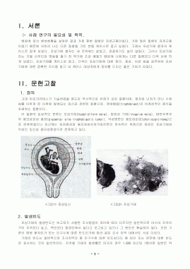포상기태 [논문] -1페이지