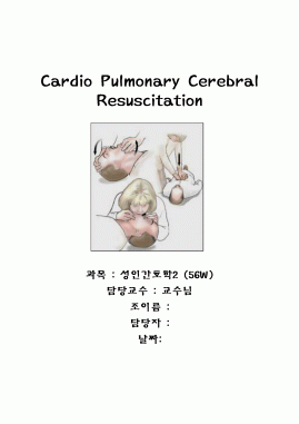 심폐소생술(CPCR, CPR) 가격 내립니다. 1000원에서 300원 ㅋㅋ-1페이지