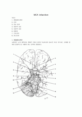 MCA infarction 레포트 자료-1페이지