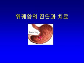 위궤양 및 십이지장궤양의 진단과 치료 (gastric ulcer diagnosis & treatment)-1페이지