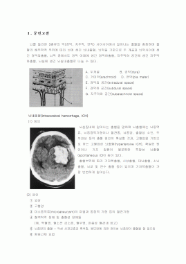 ICH(대뇌내출혈)-1페이지