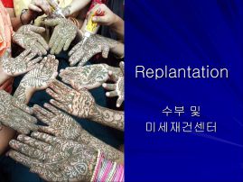 Replantation 이란?-1페이지