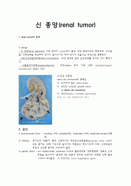 신장암 (RCC, renal cell cancer)에 대한 레포트 -1페이지