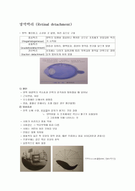 망막박리 레포트 자료-1페이지