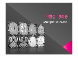 다발성 경화증 -1페이지