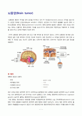 뇌종양(Brain tumor)-1페이지