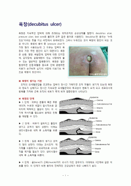 욕창(decubitus ulcer)-1페이지