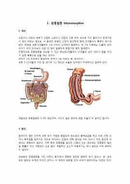 장중첩증 Intussusception-1페이지