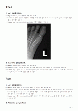 Toes(지절골,방사선)-1페이지