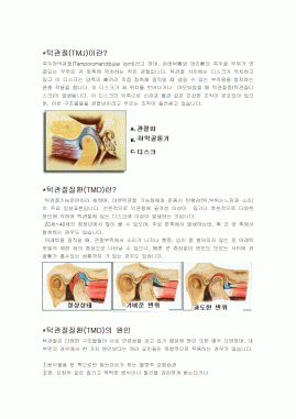 턱관절 레포트 자료-1페이지