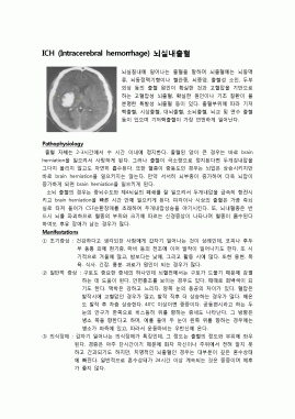 ICH 레포트 자료-1페이지