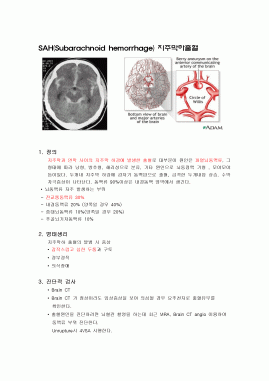 [신경외과] SAH(Subarachnoid hemorrhage) 지주막하출혈-1페이지