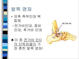[재할의학] 족부 및 발목 손상-1페이지