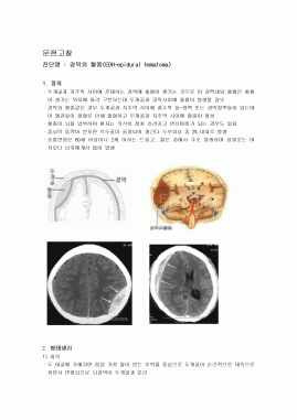 경막외혈종케이스(문헌고찰부터~간호진단까지)-1페이지