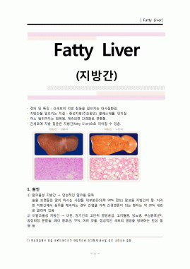 지방간 (Fatty Liver)-1페이지