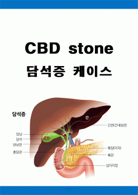 CBD stone 담석증 교수님이 예문사용한다하심 (담석증 케이스, 담석 케이스 스터디, CBD stone 케이스 스터디, gallstone 사례연구, 담석 간호과정, 담석증 사례연구)-1페이지