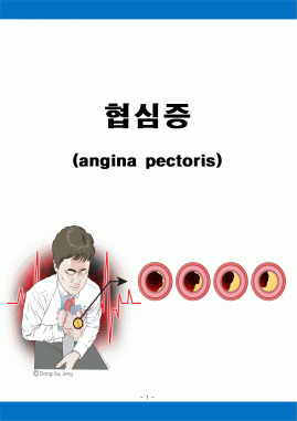 협심증(angina pectoris) 케이스 스터디-1페이지
