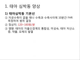 태아심박동 PPT-1페이지