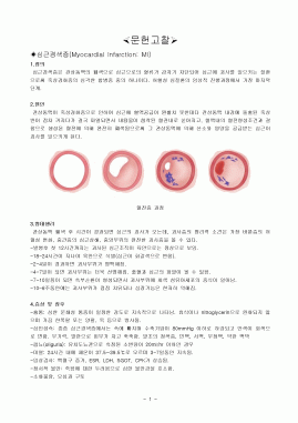 성인 MI 레포트 자료-1페이지