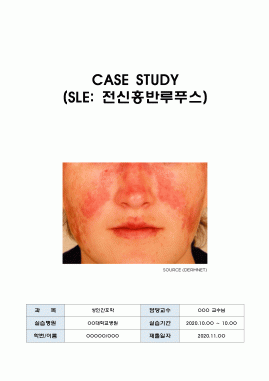 [성인간호학 자료] SLE 전신홍반루푸스 CASE STUDY (제대로 된 자료를 구매하세요.)-1페이지