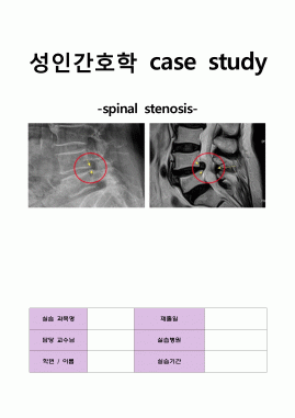 [성인간호학] Spinal stenosis(척추협착증) 간호진단 (추천)-1페이지