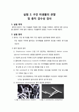 구강_미생물의_관찰_및_충치_감수성_검사-1페이지