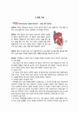 (아동) 간호학 실습 VSD 환자 case study-1페이지