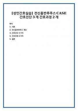 [성인간호실습] 전신홍반루푸스CASE 간호진단3개 간호과정2개-1페이지